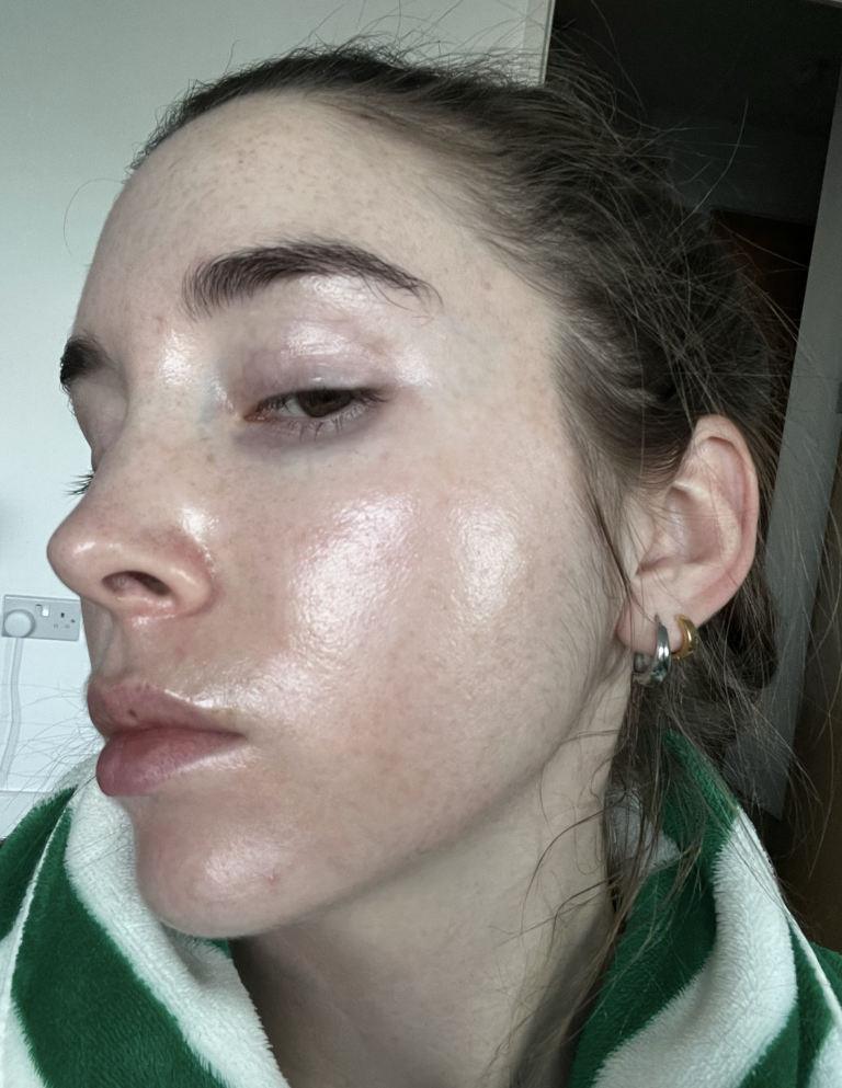 The Best Skin Barrier Products for Clog Prone Skin - Natalie O'Neill