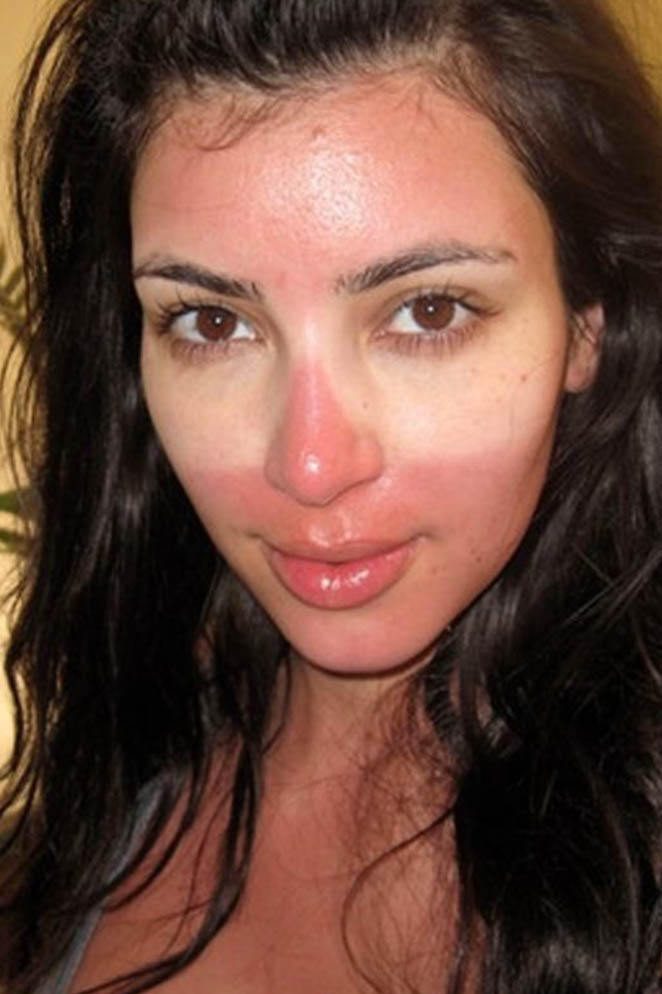 Can you get sunburn on a cloudy day? UV myths & truths - Natalie O ...